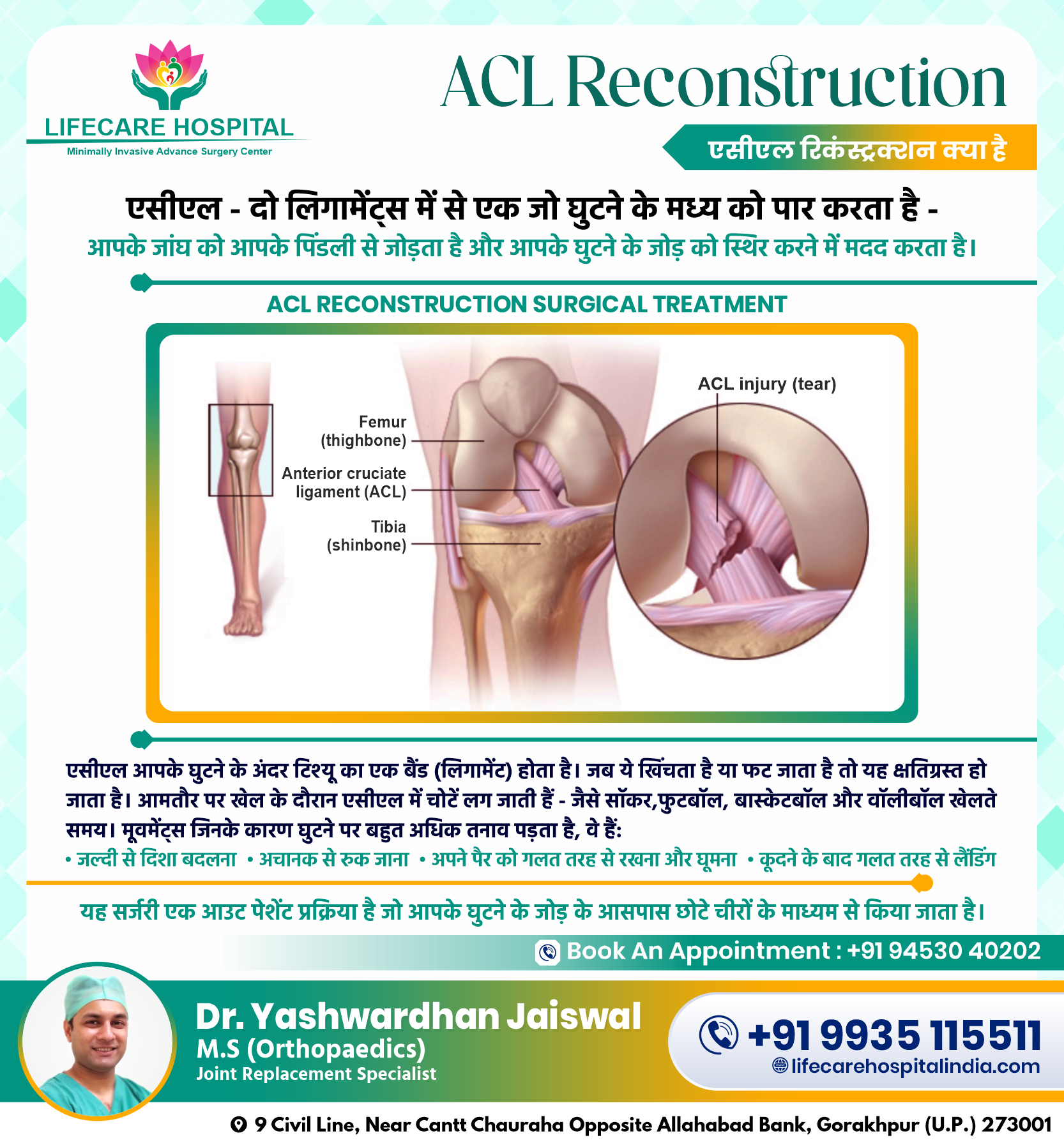 ACL Reconstruction – Dr. Yashwardhan Jaiswal Blog